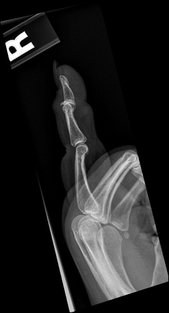 Diagnostic Imaging Consultants Second Opinion on Erosive Osteoarthritis ...