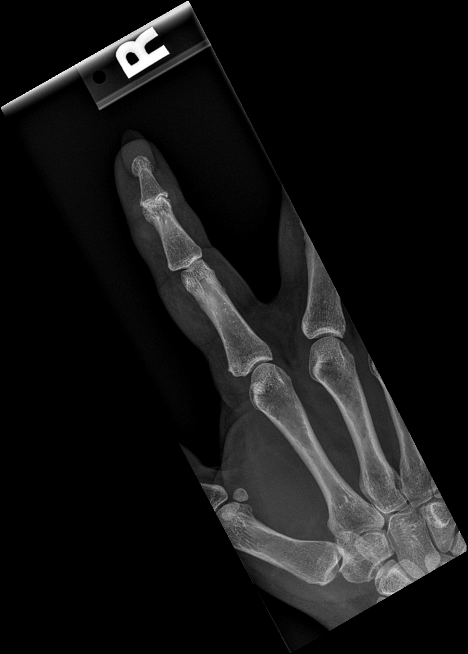 Diagnostic Imaging Consultants Second Opinion on Erosive Osteoarthritis ...